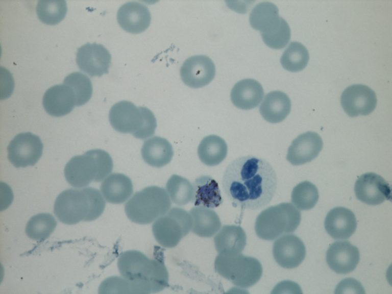 Sir Ronald Ross's Slides under the Microscope - Library, Archive & Open ...