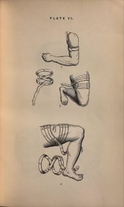 Sutures and Surgery (Historical Collection) - Library, Archive & Open ...
