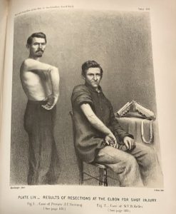 Sutures and Surgery (Historical Collection) - Library, Archive & Open ...